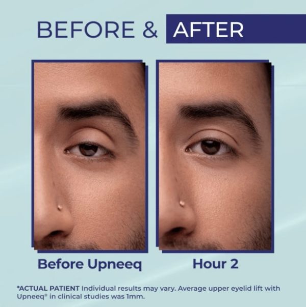 Upneeq Charleston - Cosmetic Skin Treatment Mount Pleasant SC